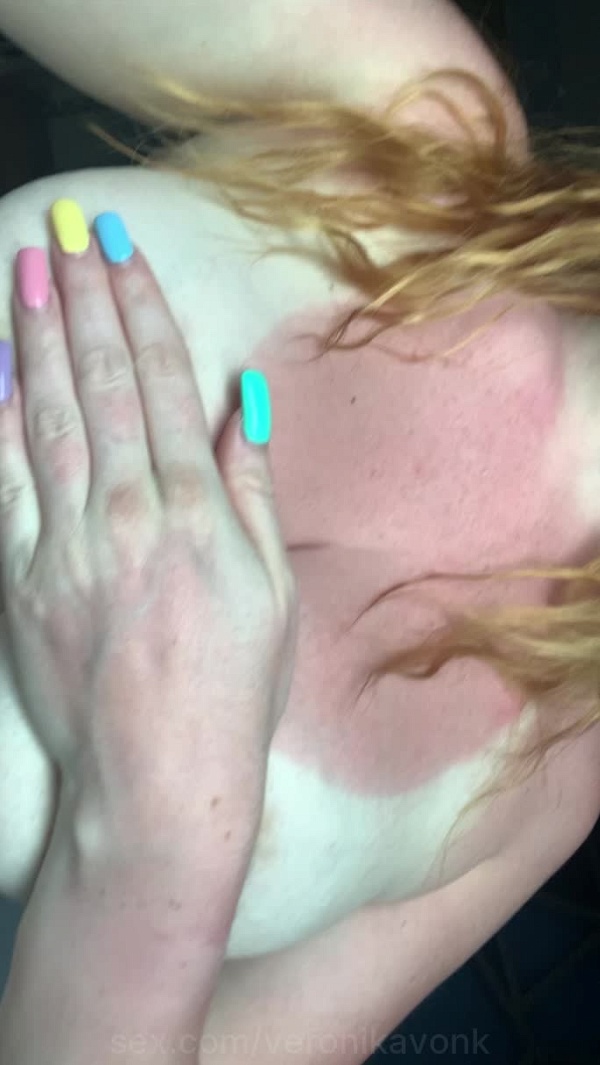 Veronikavonk Morning Of Beaches And Pool Got Me Sunburned Wanna Help Me With The Aloe Vera